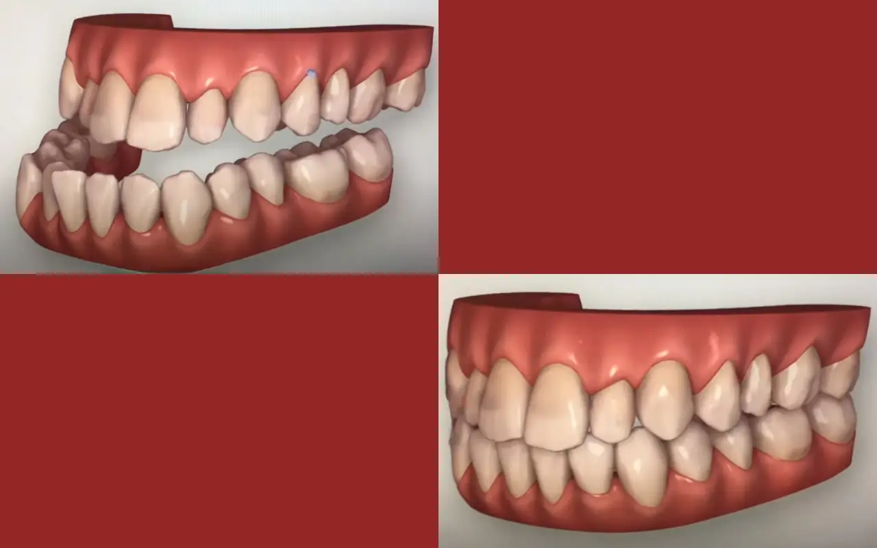 คลินิกทันตกรรม MOS Dental จัดฟัน ทำฟัน ครบวงจร ทั่วกรุงเทพ